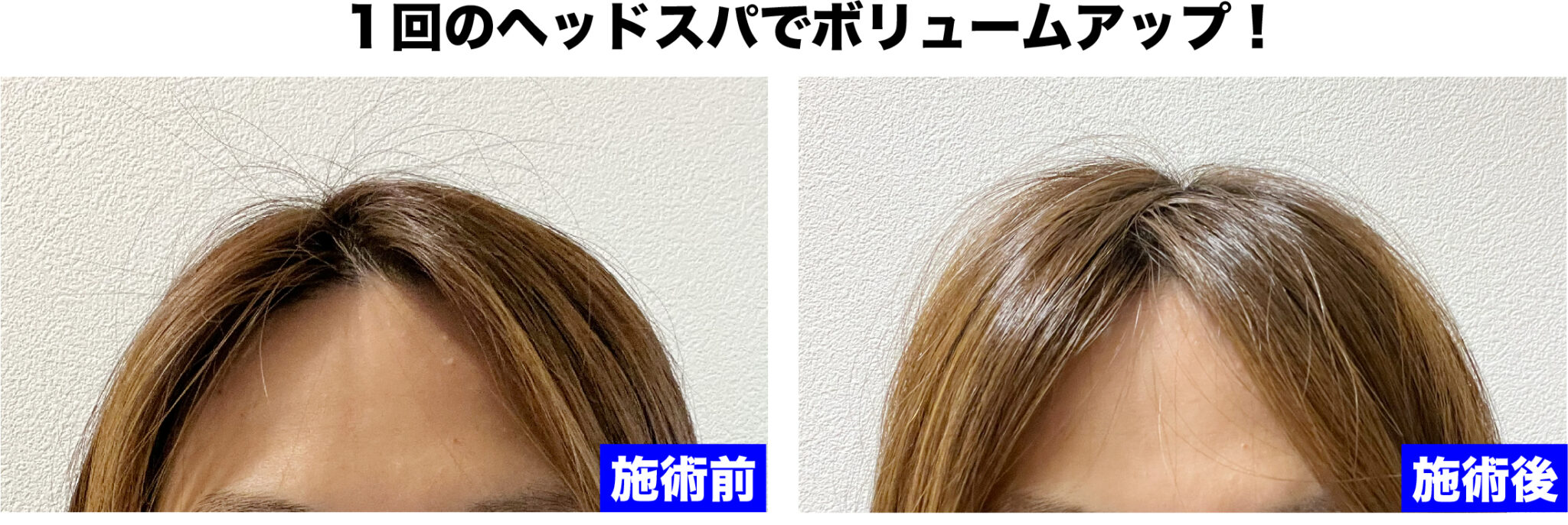 頭がスッキリしない原因は？5つの対処法で脳疲労やストレスを解消