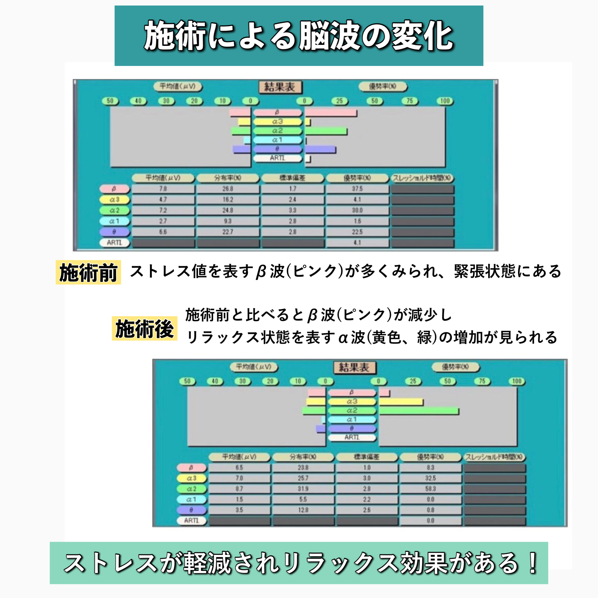ストレス値で健康状態がわかる！計測方法やストレス値の下げ方を解説